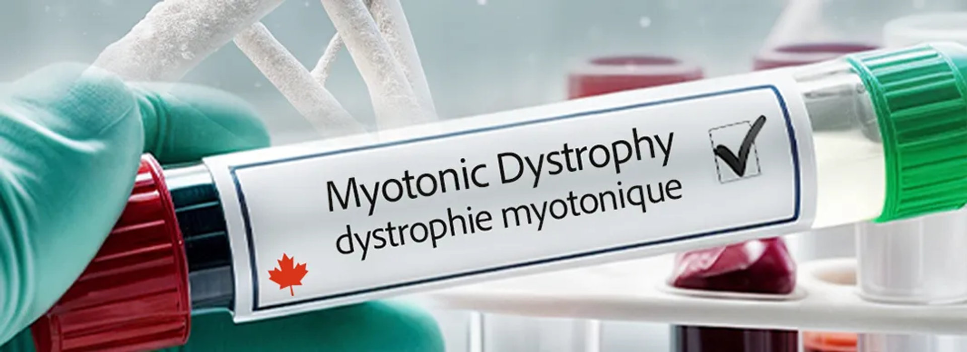 Myotonic Dystrophy Research | Muscular Dystrophy Canada